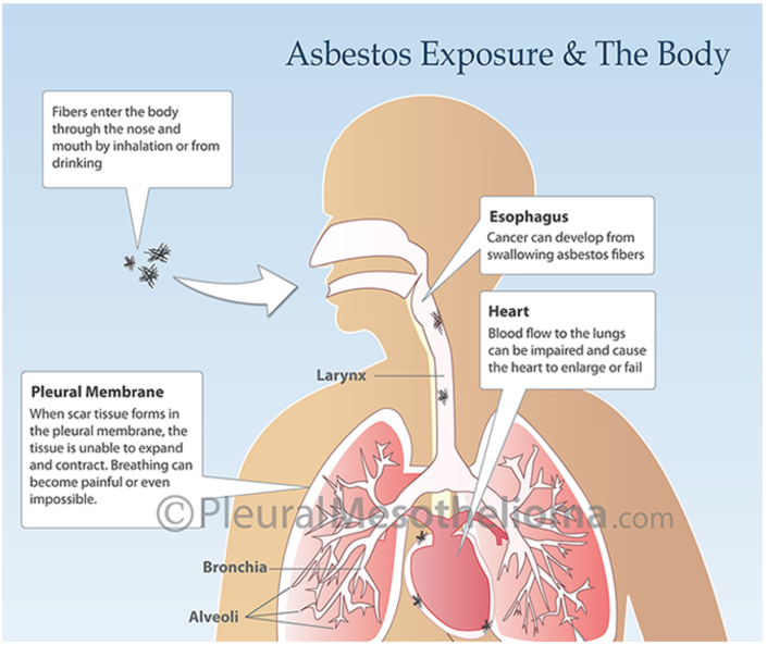 Asbestos – Home Run Inspections, LLC